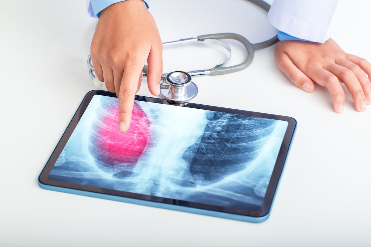 Free lung checks for the Toowoomba region - Safe To Work
